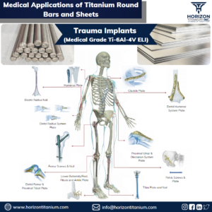 Medical Applications of Titanium Round bars and Sheets (Trauma Implants ...
