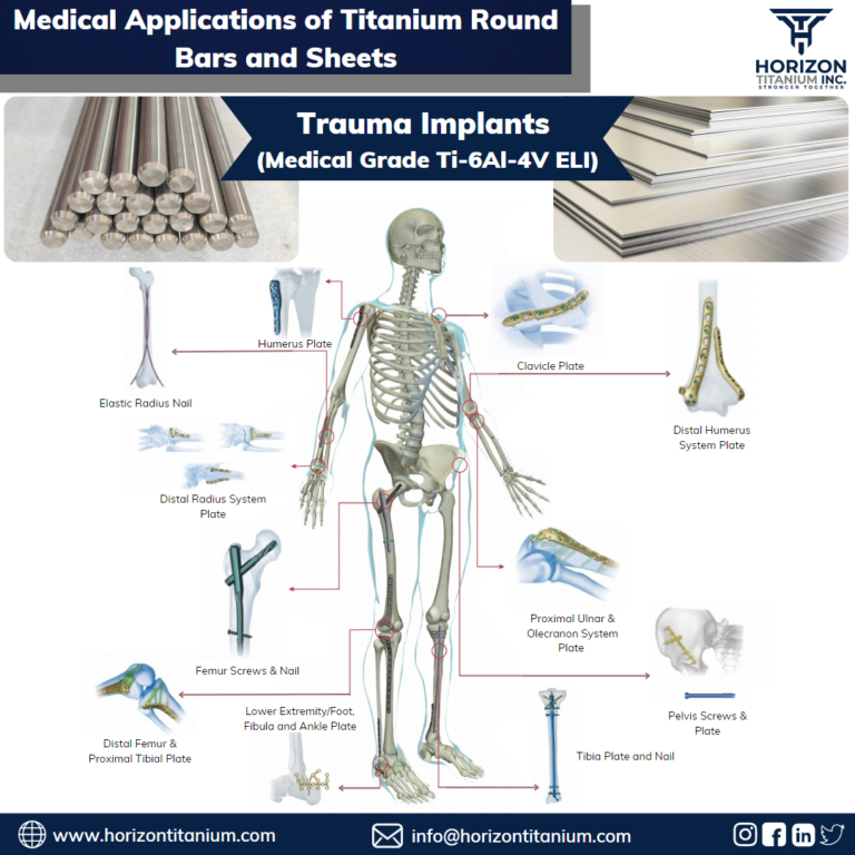 Medical Applications of Titanium Round bars and Sheets (Trauma Implants ...